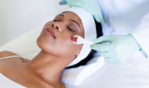 How Long After Microneedling Can I Wear Makeup?