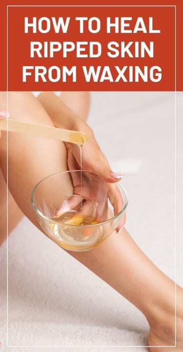 How To Heal Ripped Skin From Waxing