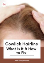 What Is A Cowlick And How To Fix It?