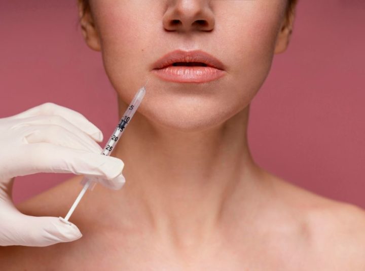 Botox For Smile Lines: Procedure, Safety Tips, And More