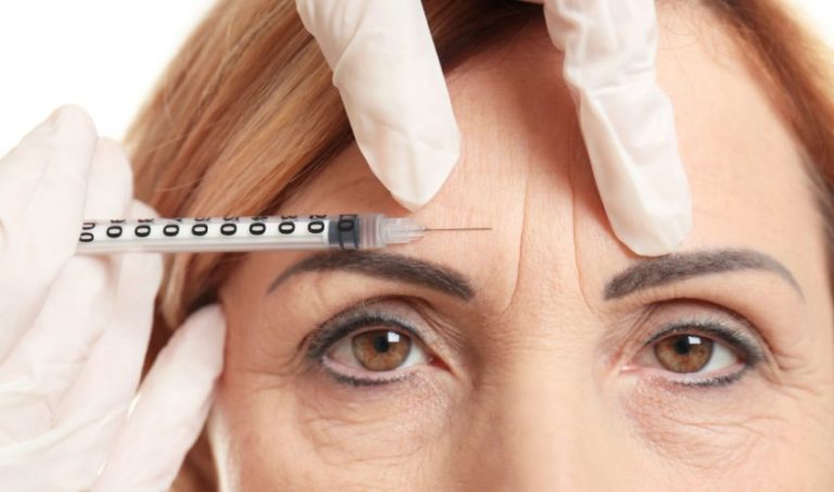 Botox For Smile Lines: Procedure, Safety Tips, And More