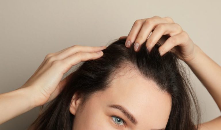 What Is A Cowlick And How To Fix It?