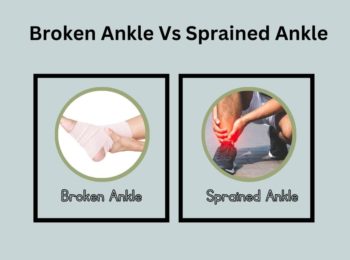 Broken Ankle Vs. Sprained Ankle: How To Tell The Difference?