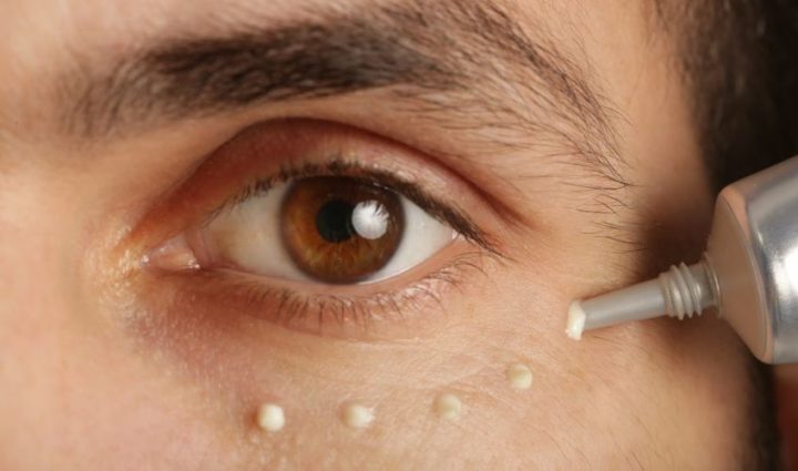 Brown Spot On Your Eye: What This Happens And How To Treat It