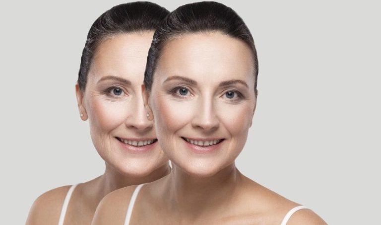 Daxxify Vs Botox: Which Is Best For You