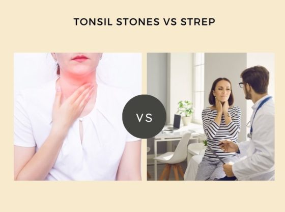 Tonsillitis Vs. Strep: How To Identify And Treat Them
